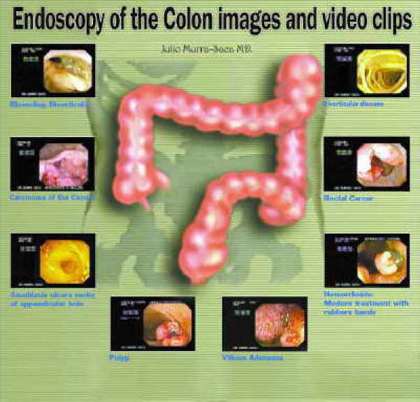 The Colon - Notes on Cyber Gastroenterology - murrasaca.com